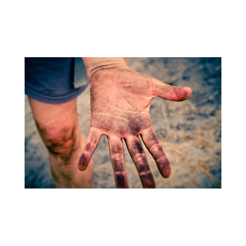 PPE protection of the skin (cuts and other injuries)